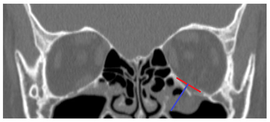 Correlation between Tomography Scan Findings and Clinical Presentation ...