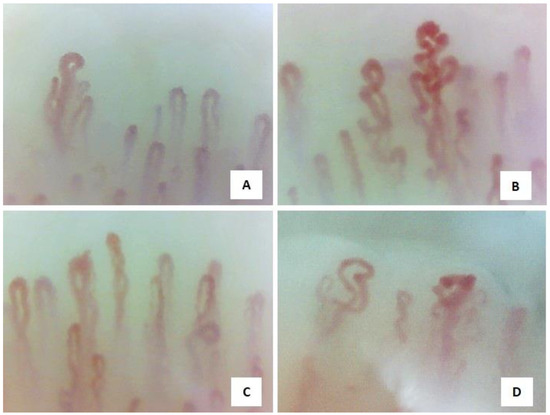 Nailfold Capillaroscopy Analysis Can Add a New Perspective to Biomarker ...