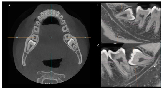 Spatial Position and Anatomical Characteristics Associated with ...