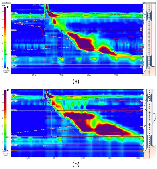 A Comparison between Chicago Classification Versions 3.0 and 4.0 and ...