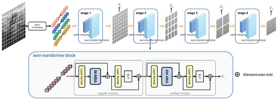 Diagnostics | Free Full-Text | Swin-Net: A Swin-Transformer-Based ...