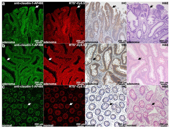 Near-Infrared In Vivo Imaging of Claudin-1 Expression by Orthotopically ...