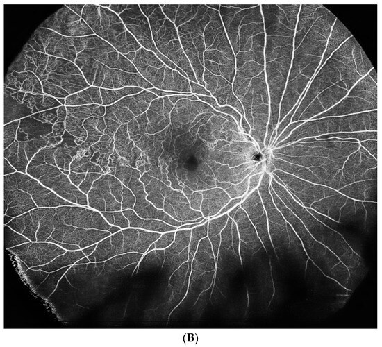 Diagnostics | Free Full-Text | Advantages of the Utilization of Wide ...
