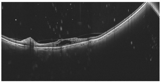 Diagnostics | Free Full-Text | Advantages of the Utilization of Wide ...