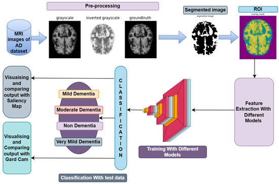 An Explainable AI Paradigm for Alzheimer’s Diagnosis Using Deep ...