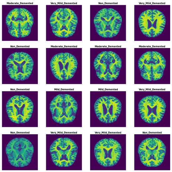 An Explainable AI Paradigm for Alzheimer’s Diagnosis Using Deep Transfer Learning