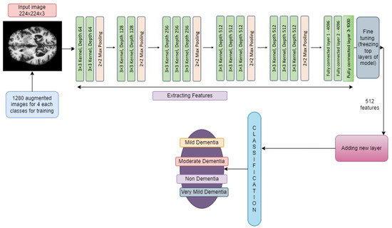 An Explainable AI Paradigm for Alzheimer’s Diagnosis Using Deep ...