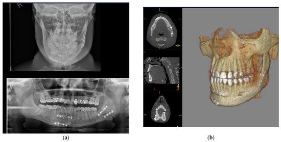 Diagnostics | Free Full-Text | The Application of Cone Beam Computed ...