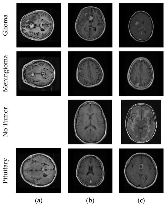 A Novel Ensemble Framework for Multi-Classification of Brain Tumors ...
