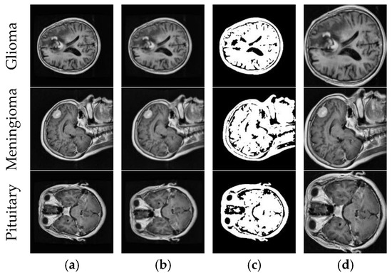 A Novel Ensemble Framework for Multi-Classification of Brain Tumors ...
