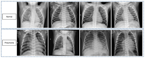 Diagnostics | Free Full-Text | A Deep Convolutional Neural Network for ...