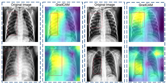 Diagnostics | Free Full-Text | A Deep Convolutional Neural Network for ...