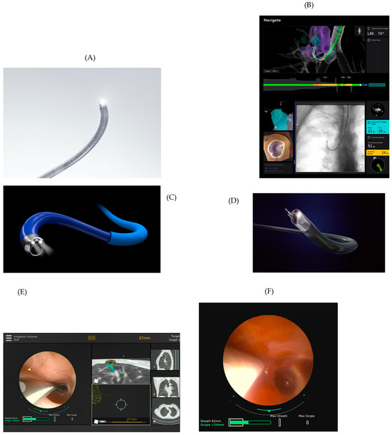 Robotic-Assisted Bronchoscopy: A Comprehensive Review of System ...