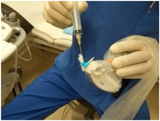 Ultrasound-Guided Interventions in the Biliary System