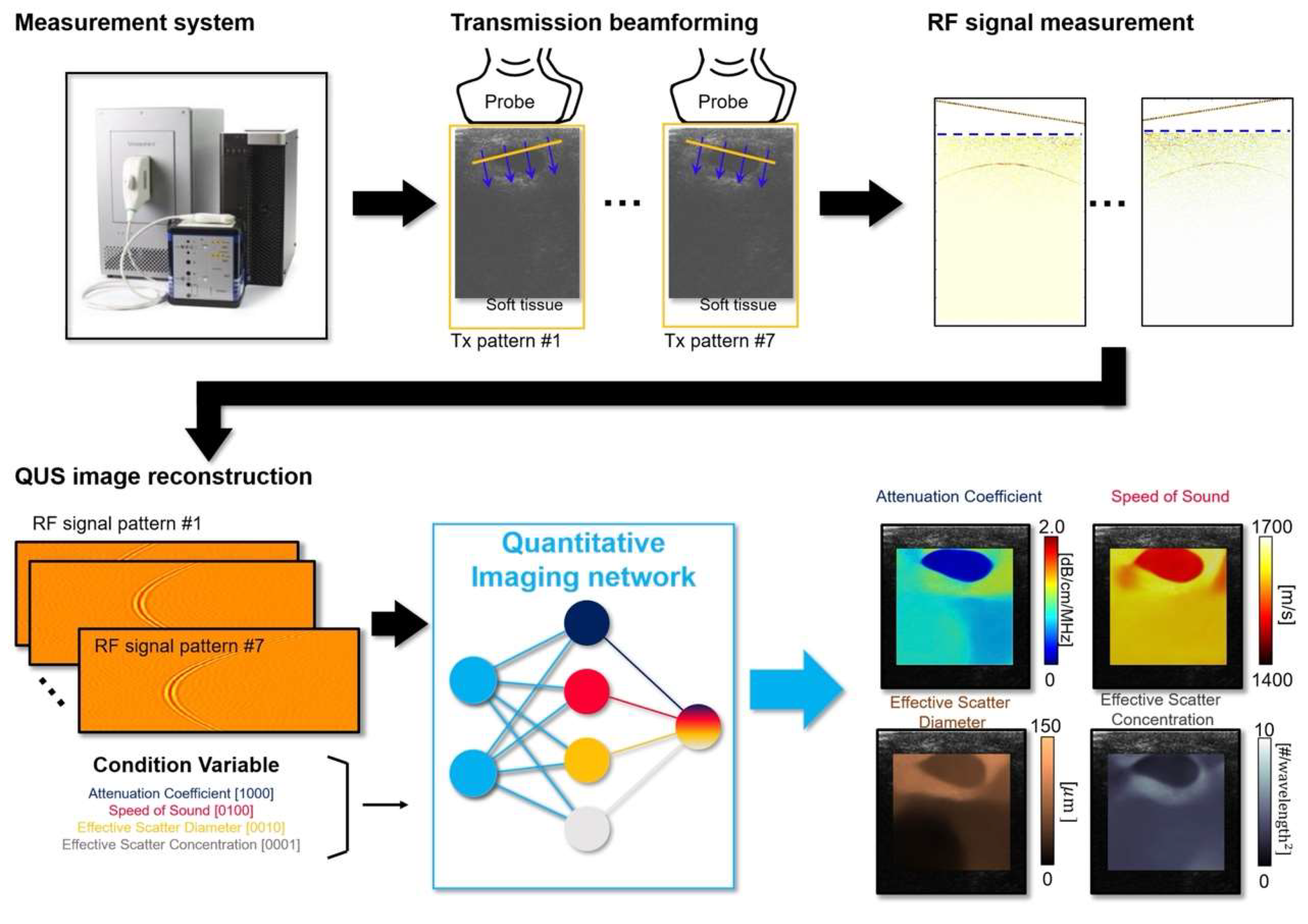 Artificial Intelligence-Enhanced Quantitative Ultrasound for Breast ...