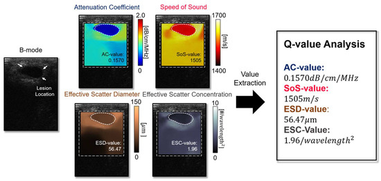 Artificial Intelligence-Enhanced Quantitative Ultrasound for Breast ...