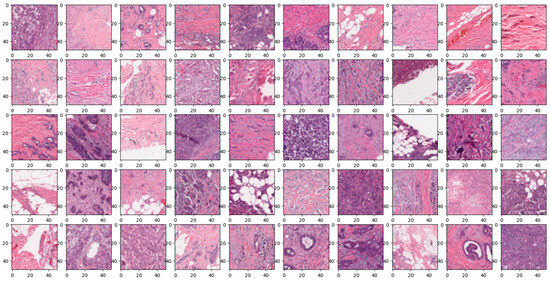 Diagnostics | Free Full-Text | Revolutionizing Breast Cancer Diagnosis ...