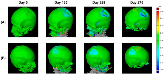 Long-Term Comparison of Two- and Three-Dimensional Computed Tomography ...