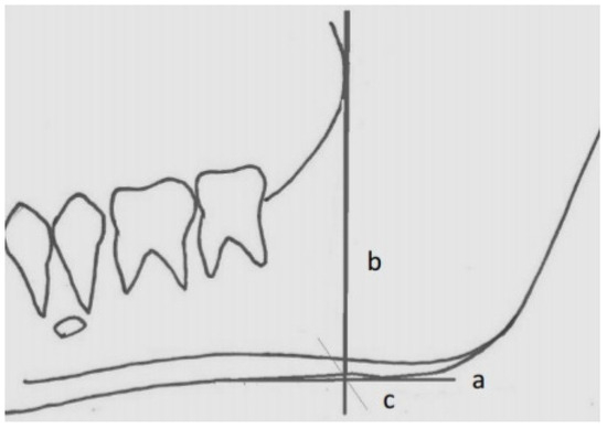 Diagnostics | Free Full-Text | Relationship between Skeletal ...