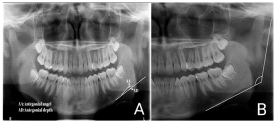 Diagnostics | Free Full-Text | Relationship between Skeletal ...
