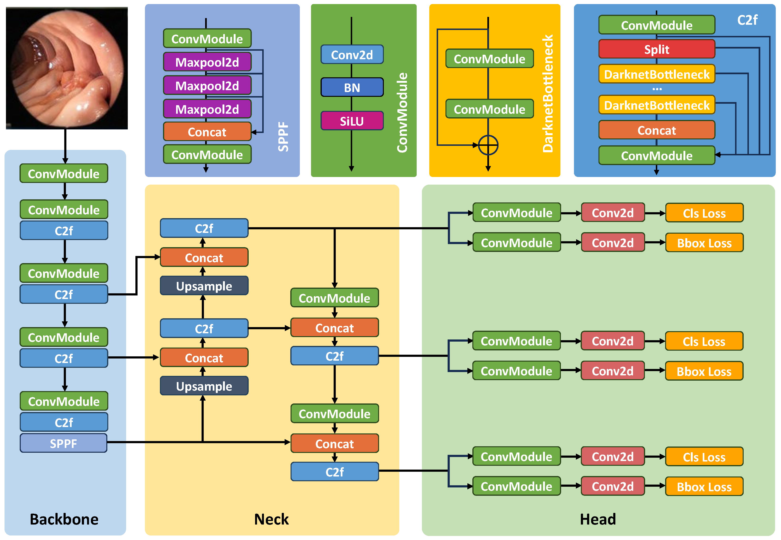 Polypoid Lesion Segmentation Using YOLO-V8 Network in Wireless Video ...