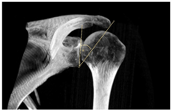 The Modified Ultrasound-Assisted Method: A Study of the Correlation ...
