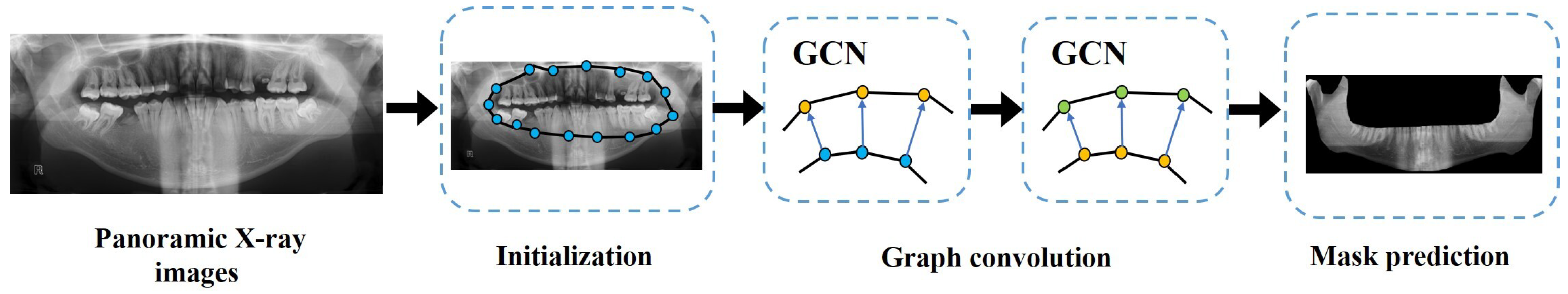 Diagnostics | Free Full-Text | STSN-Net: Simultaneous Tooth Segmentation and Numbering Method in ...