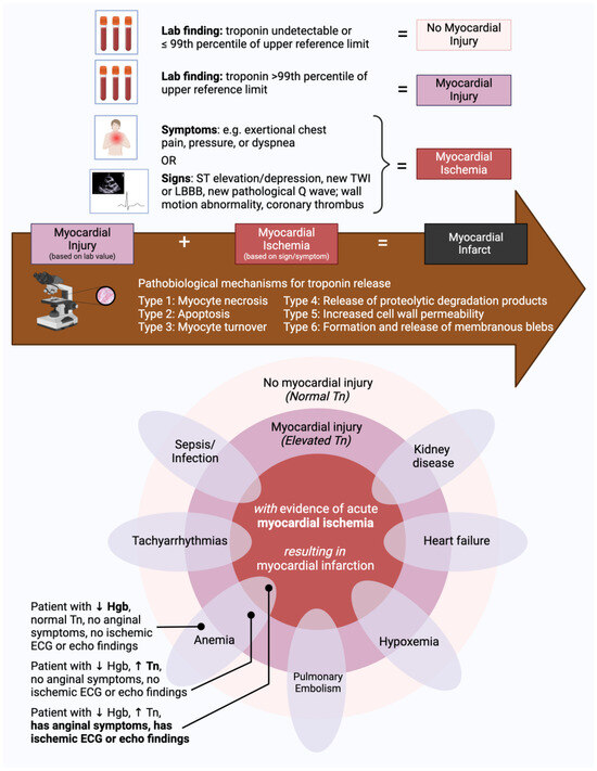 Clinical Interpretation of Serum Troponin in the Era of High ...