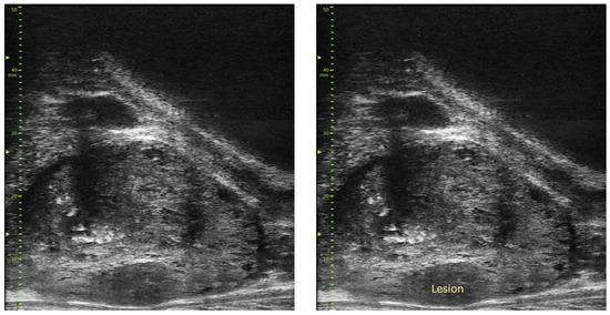 A Comparative Evaluation of Multiparametric Magnetic Resonance Imaging ...