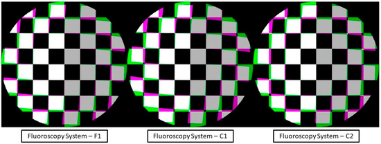 Enhancing Single-Plane Fluoroscopy: A Self-Calibrating Bundle ...