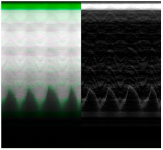 Enhancing Single-Plane Fluoroscopy: A Self-Calibrating Bundle ...