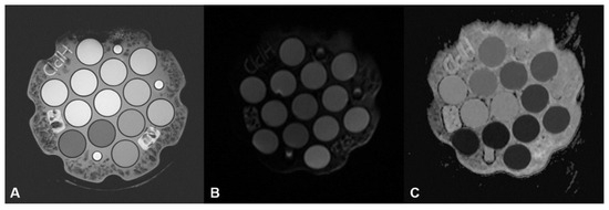 Whole Process of Standardization of Diffusion-Weighted Imaging: Phantom Validation and Clinical ...