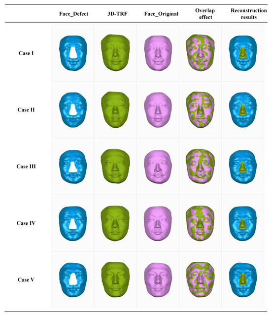 Three-Dimensional Virtual Reconstruction of External Nasal Defects ...