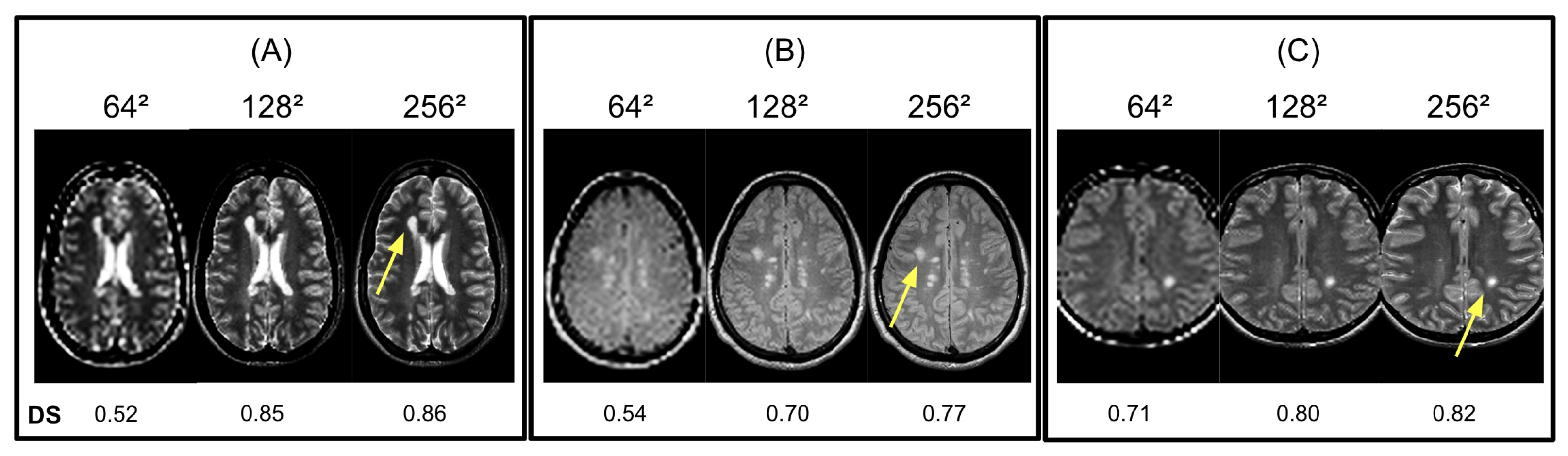Diagnostics | Free Full-Text | Automatic Active Lesion Tracking in ...