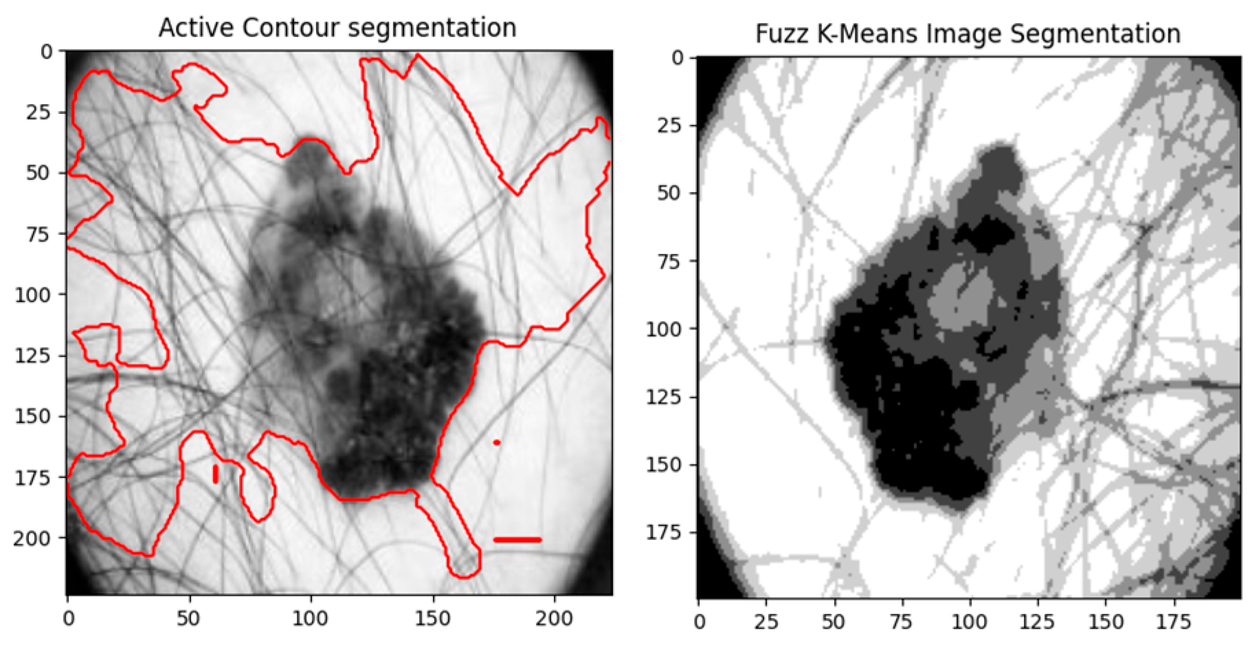 Diagnostics | Free Full-Text | An Improved Skin Lesion Classification Using a Hybrid Approach ...