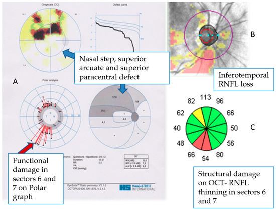 Diagnostics | Free Full-Text | Correlation between Structural and ...
