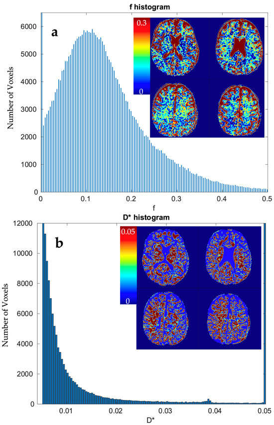 Evaluation of Whole Brain Intravoxel Incoherent Motion (IVIM) Imaging