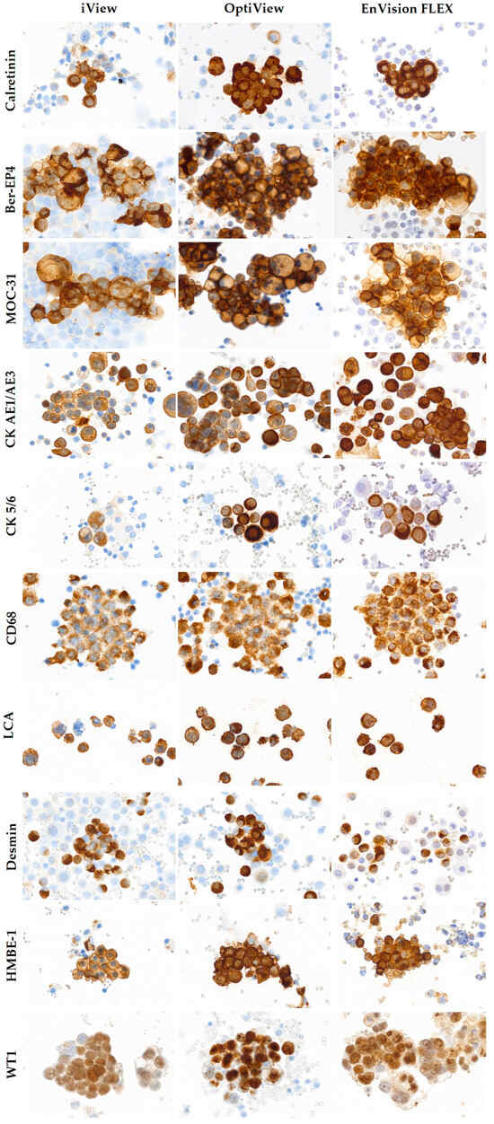 Validation and Implementation of OptiView and EnVision FLEX Detection ...