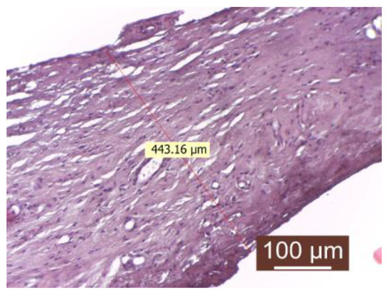 A Histological Evaluation of the Efficiency of Using Periprosthetic ...