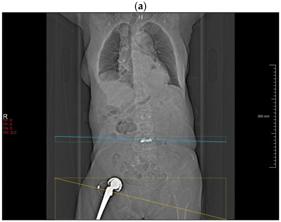 Development and Validation of a Deep-Learning-Based Algorithm for Detecting and Classifying ...