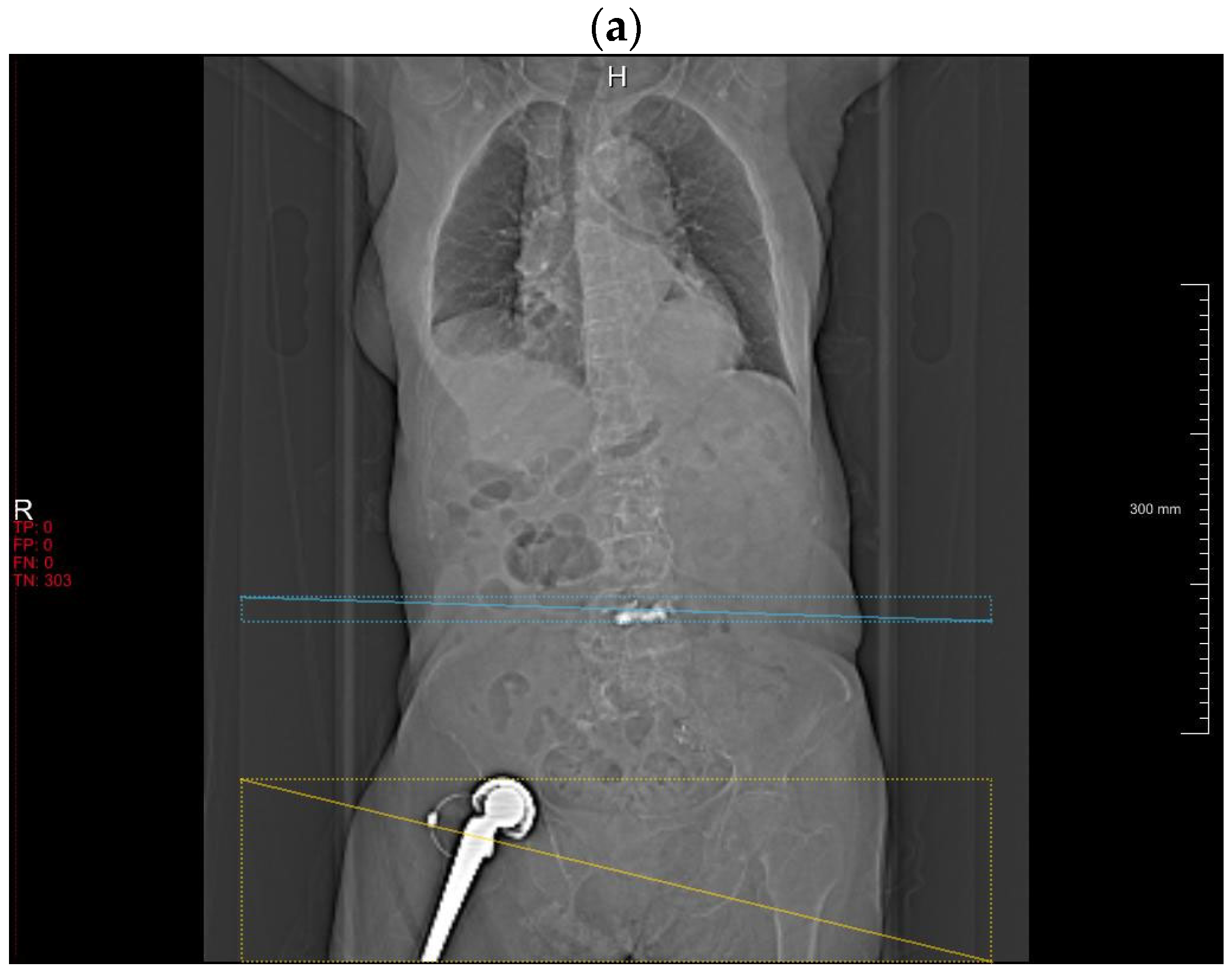 Development and Validation of a Deep-Learning-Based Algorithm for Detecting and Classifying ...