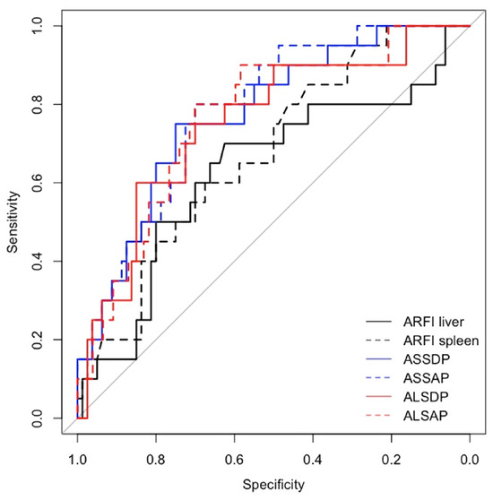 Acoustic Radiation Forced Impulse of the Liver and the Spleen, Combined ...