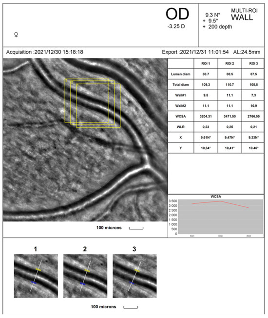 Diagnostics Free Full Text Retinal Microcirculation Measurements In