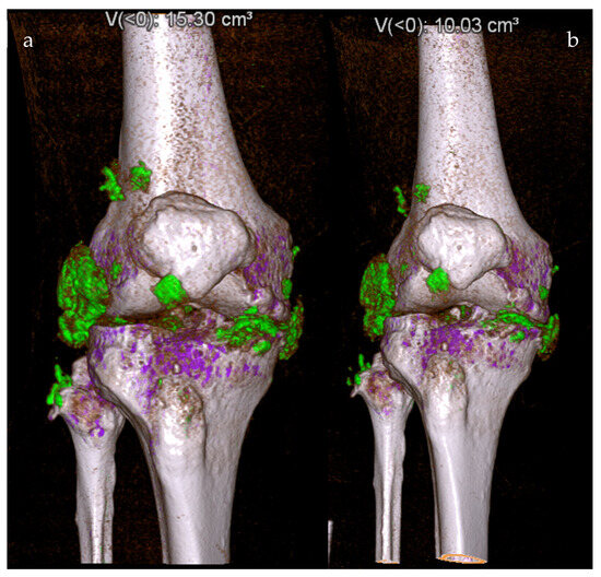 Updates on the Applications of Spectral Computed Tomography for ...