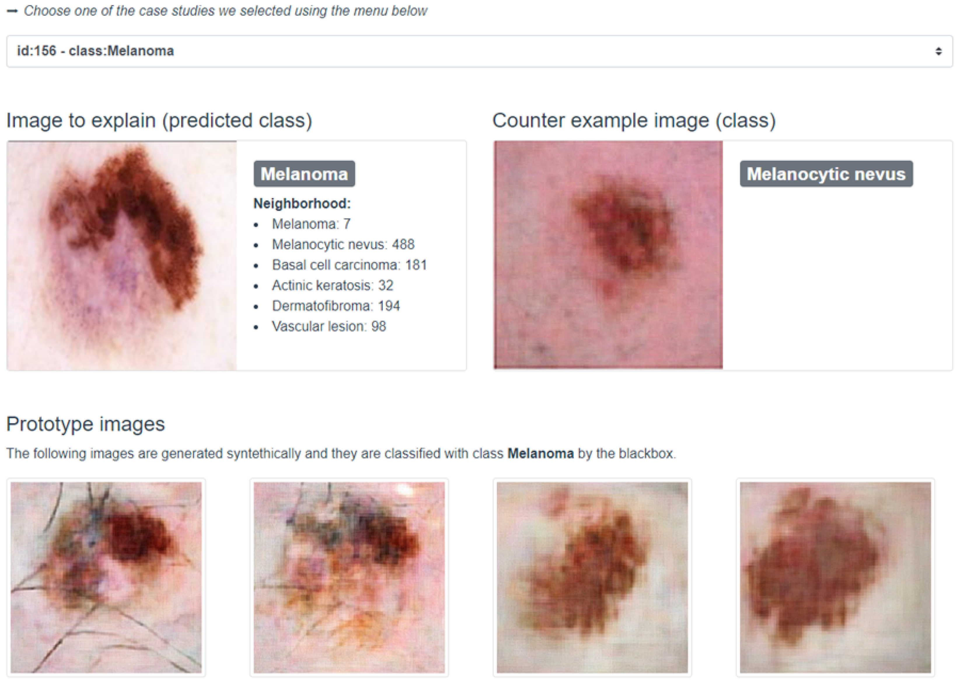Advancing Dermatological Diagnostics: Interpretable AI for Enhanced ...