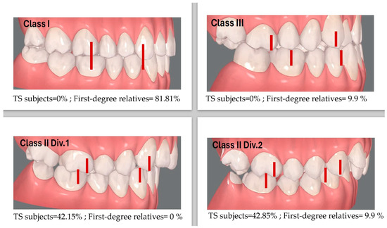 Comprehensive Oral Diagnosis and Management for Women with Turner Syndrome