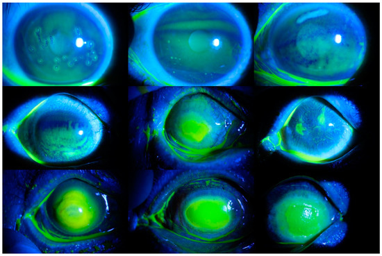 Diagnostics | Free Full-Text | Classification and Determination of ...