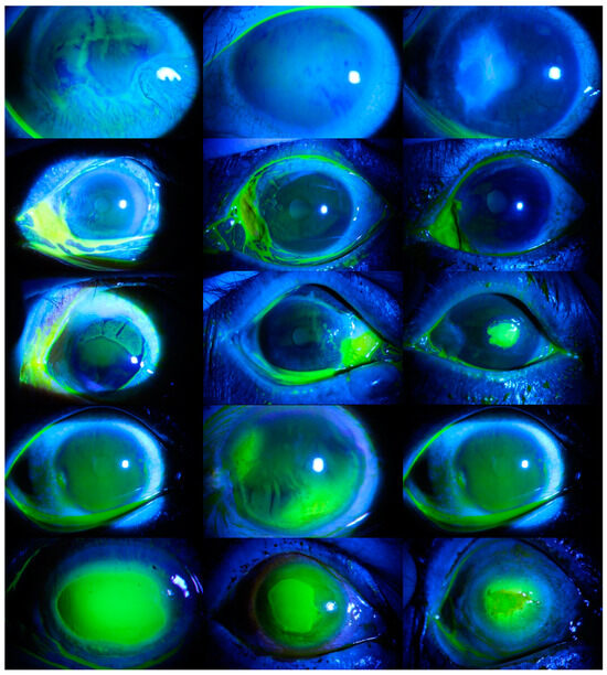 Diagnostics | Free Full-Text | Classification and Determination of ...