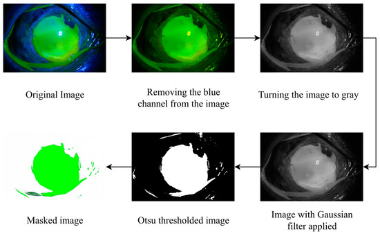 Diagnostics | Free Full-Text | Classification and Determination of Severity of Corneal Ulcer ...