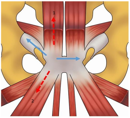 The Role of MRI in Groin Pain Syndrome in Athletes